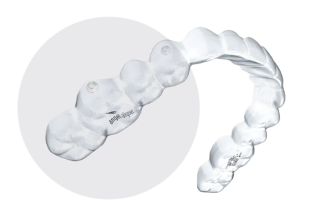 Teeth Straightening - Invisalign and Angel